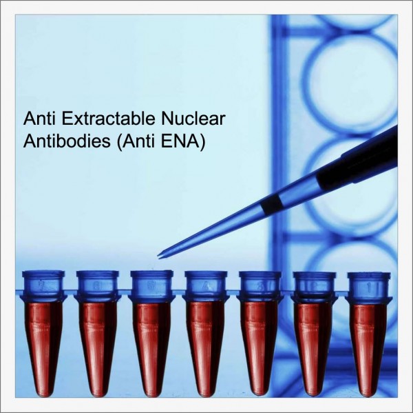 اختبار ENA | İstanbul Laboratuvarları