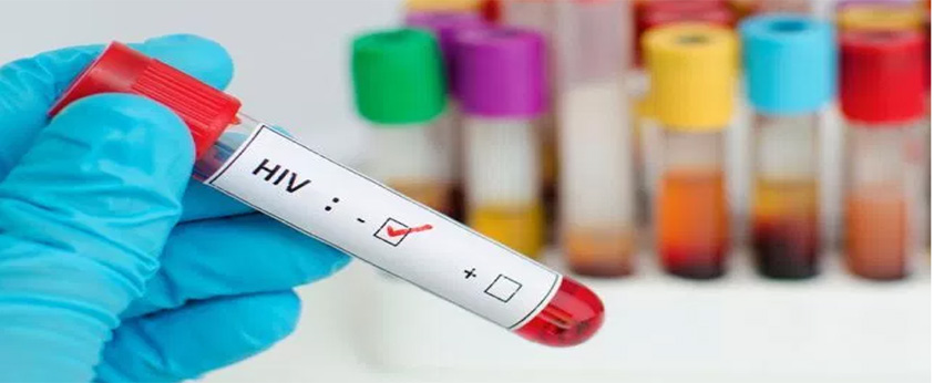 HIV Combo Test | İstanbul Laboratuvarları